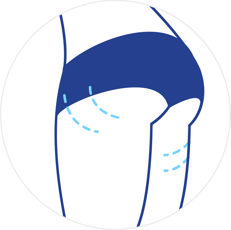 Dermapen - Acacia Skin Health & Beauty