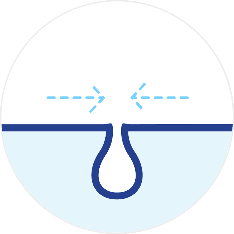 Dermapen - Acacia Skin Health & Beauty